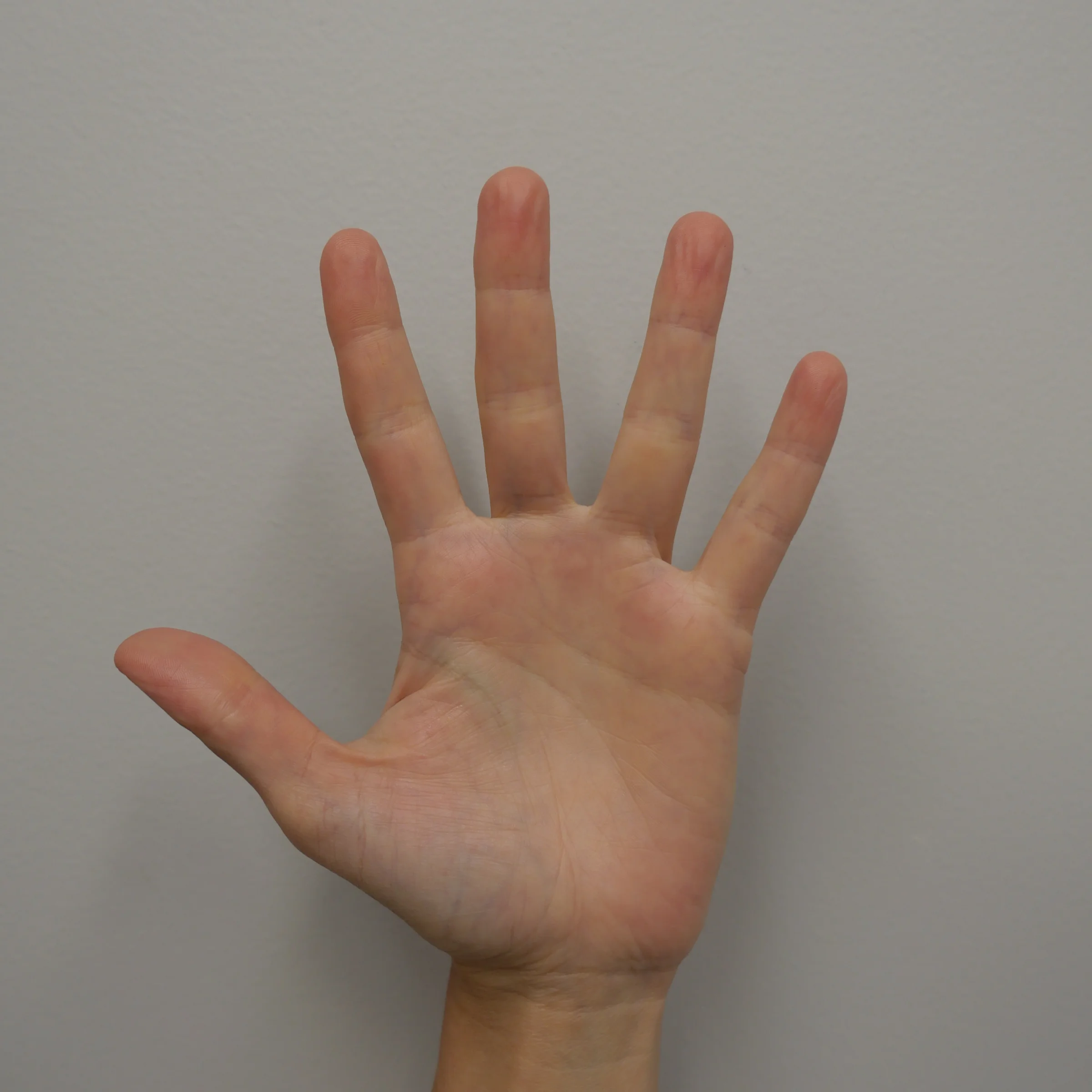Hand patient education | CQ Hand + Upper Limb